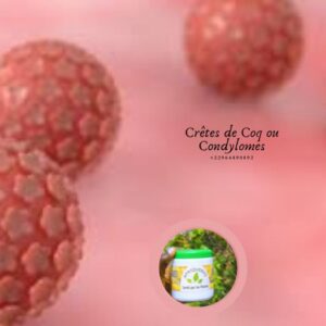 Crêtes de Coq ou Condylomes Traitement Naturel Crêtes de Coq